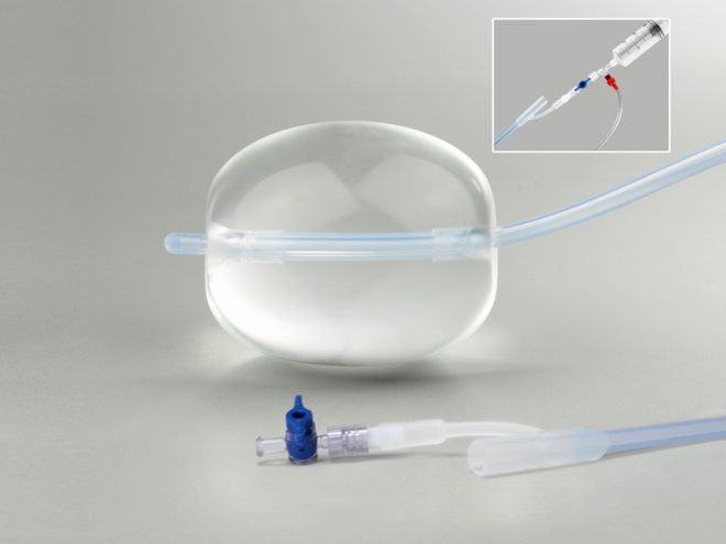 Cook Bakri® Postpartum Balloon with Rapid Instillation – Obex