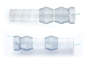 Oesophageal and Enteral Metal Stents – Obex