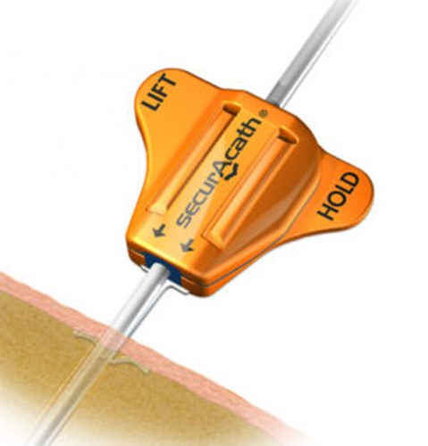 SecurAcath® – Obex