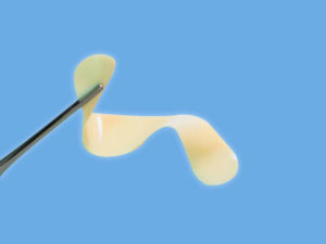 Vascular Surgery – Obex