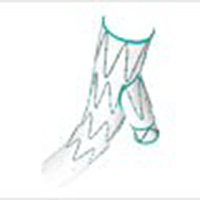 Cook® Beacon Tip Van Schie Seeking Catheters and Van Schie Over-The-Top ...