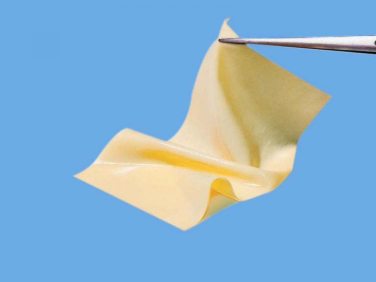 Synovis Peri-Guard® Repair Patch – Obex