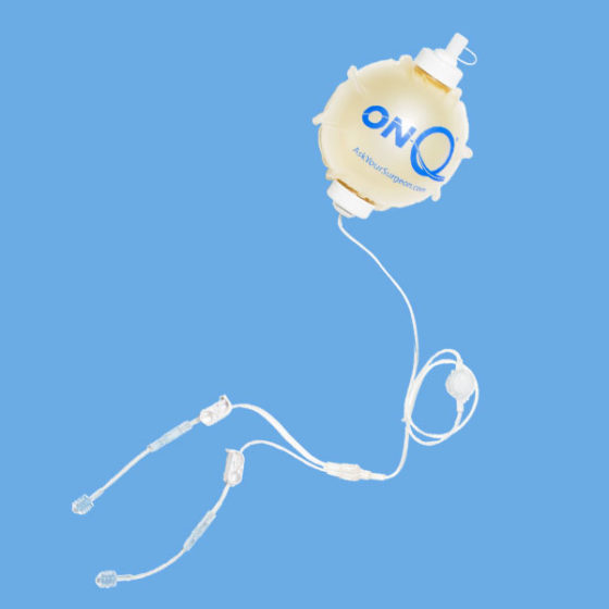 Obex Products – Obex